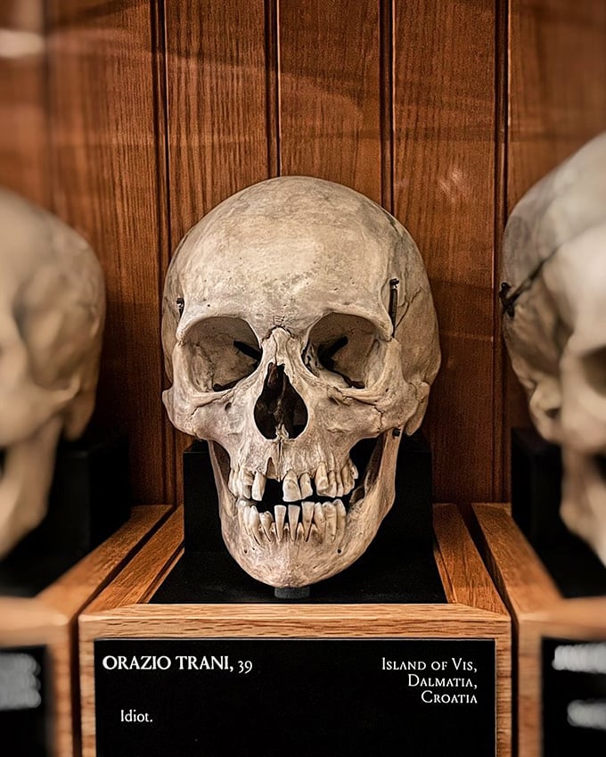 These silent sentinels of bone tell stories centuries old, their empty eye sockets having witnessed the evolution of medical understanding from superstition to science.