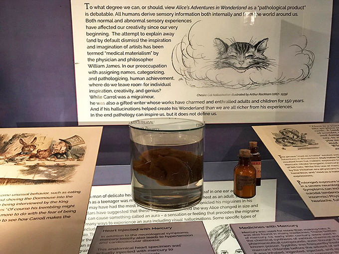 This preserved specimen floating in its glass home reminds us that even our most vital organs have a strange, otherworldly beauty when viewed through scientific eyes. 