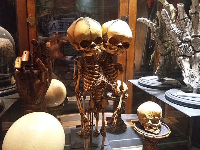 These conjoined skeletons give new meaning to the phrase "joined at the hip." Family reunions must have been complicated.