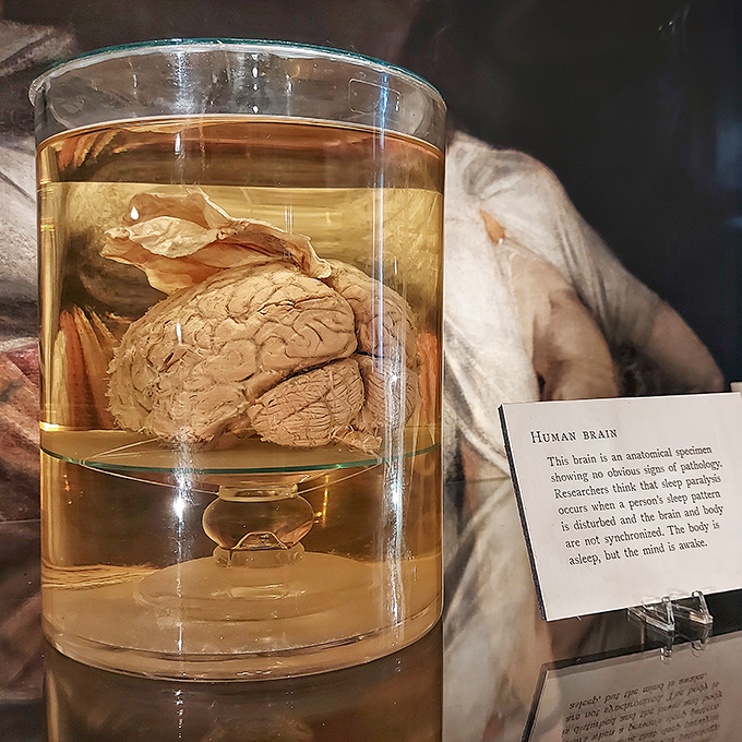 "The body is asleep, but the mind is awakened" &ndash; a preserved human brain floating eerily in solution makes you ponder your own gray matter.