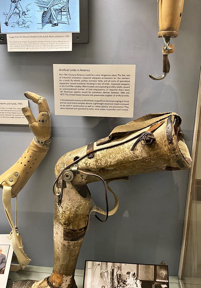 Civil War-era prosthetics showcase remarkable ingenuity in the face of tragedy. These artificial limbs tell stories of resilience and human adaptation.