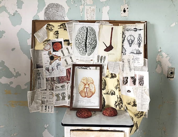 Medical diagrams and anatomical models remind visitors this was once a place of treatment, however primitive by today's standards.