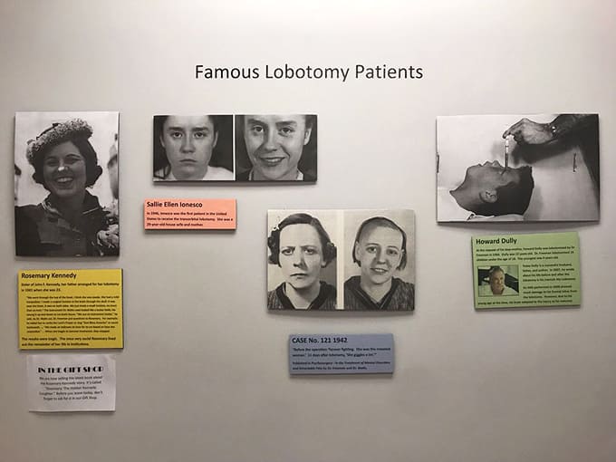 These photographs document famous lobotomy patients, their before-and-after images telling stories that words alone cannot convey adequately.